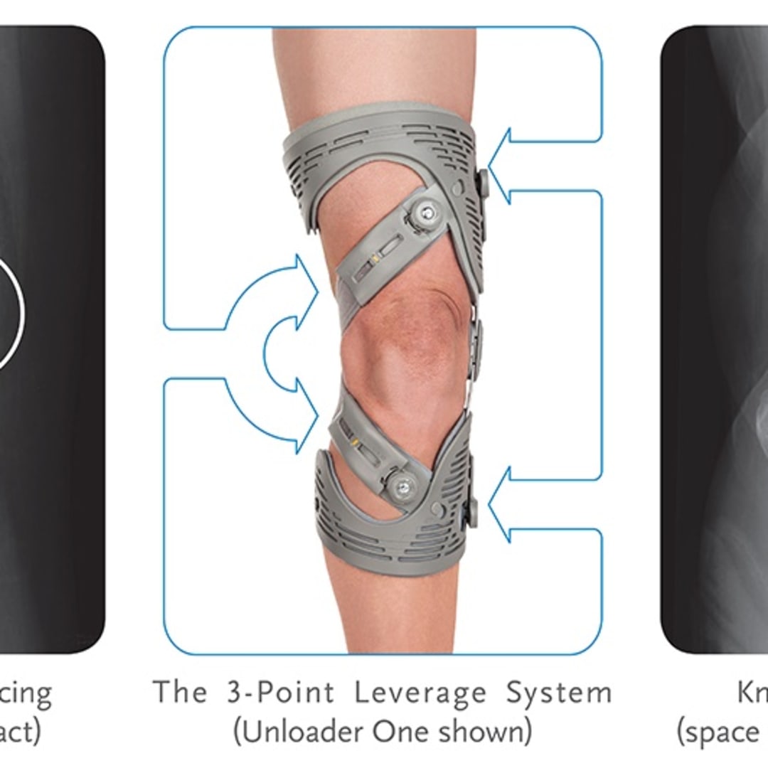 FAQs about Unloader braces. Össur.com