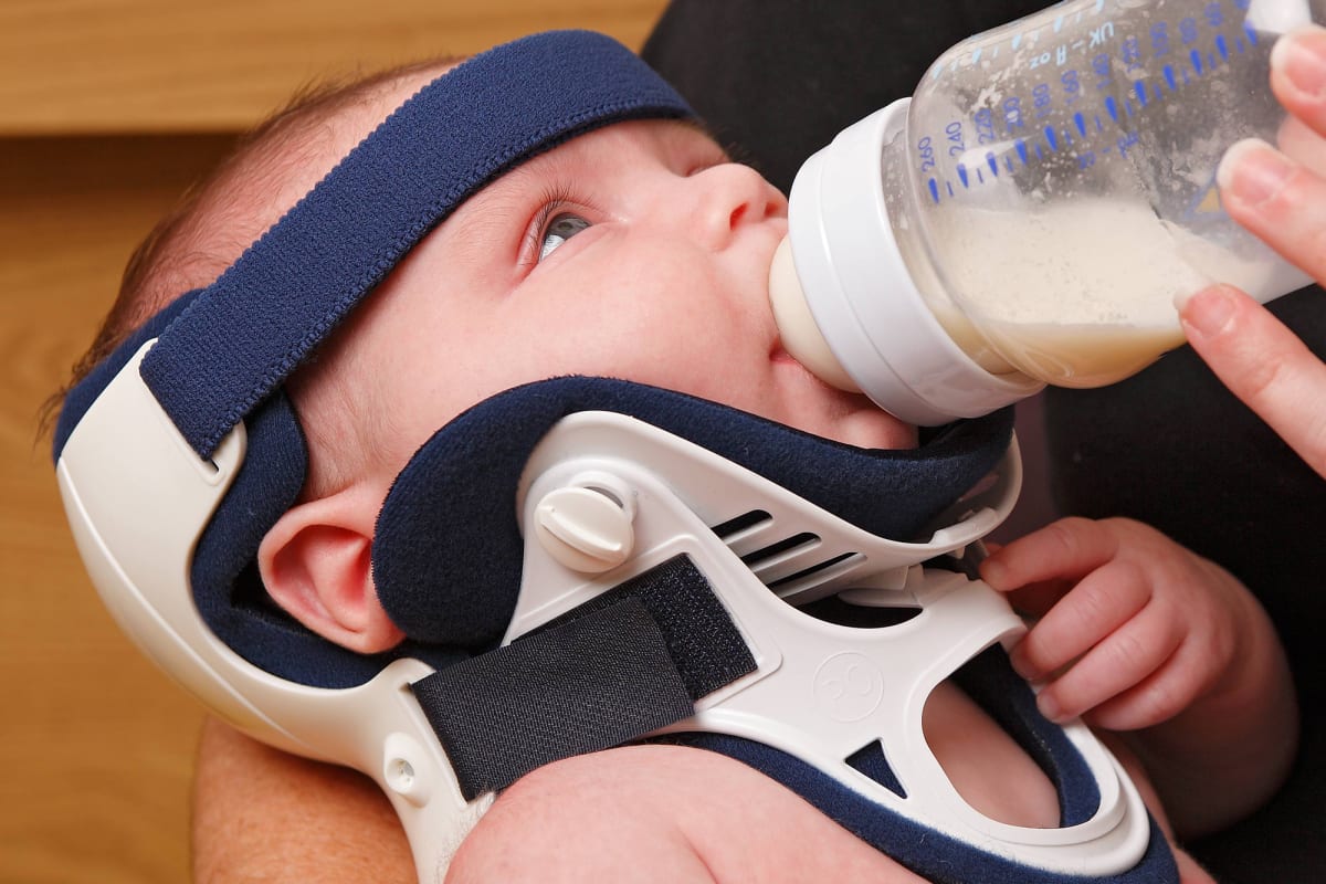 Miami®— Cervical collars. Ossur.com