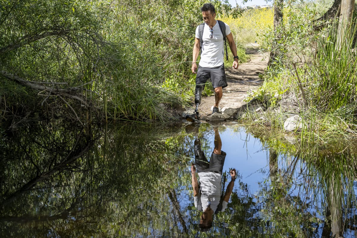 Pro-Flex® Family—Innovative Prosthetic Foot Designs for Mobility. Ossur.com