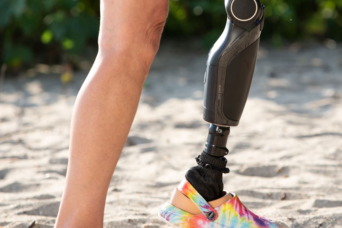 Prothèses de jambe et mains bioniques | Össur