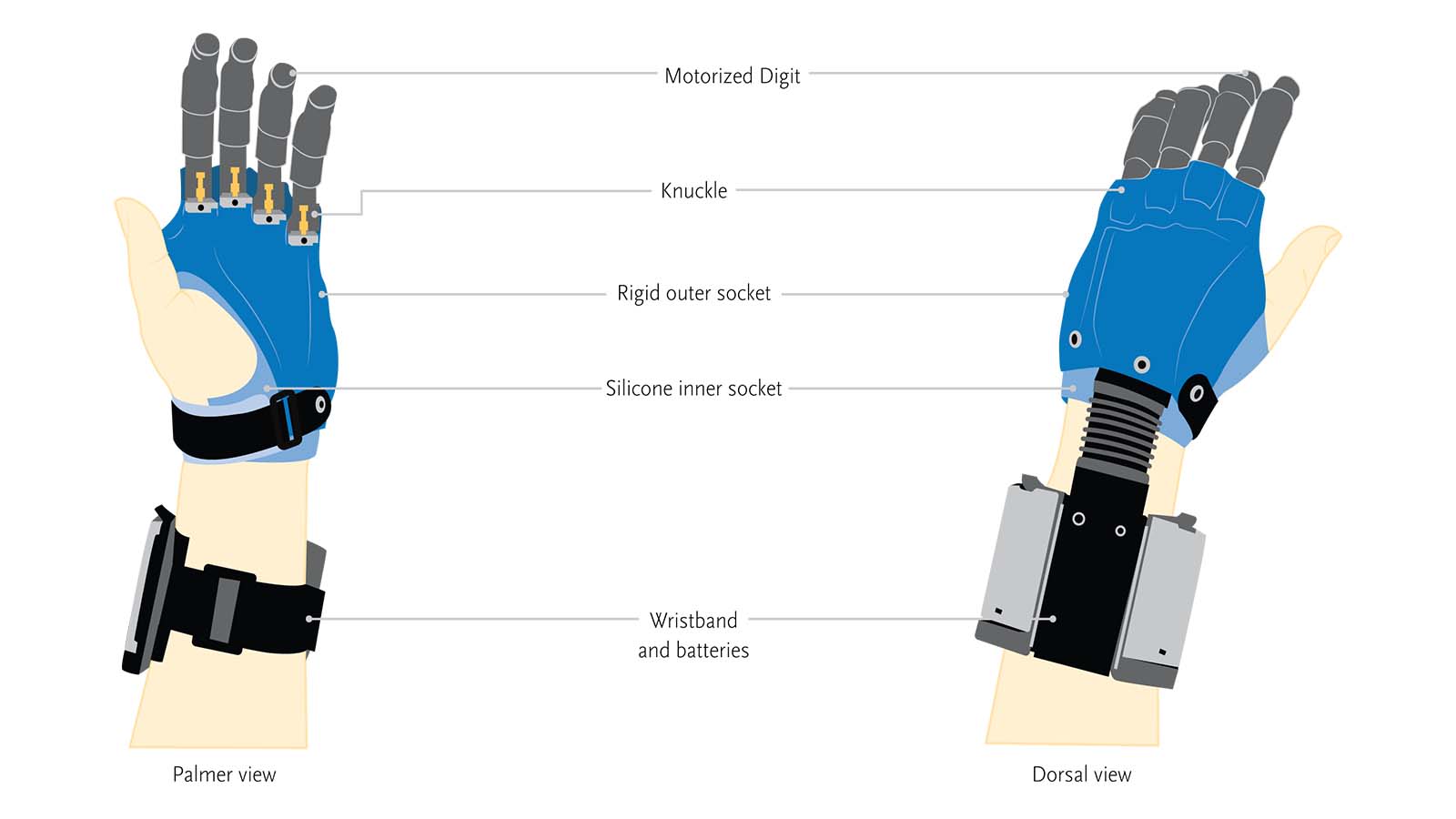 Introduction to i-Digits | Össur Academy Touch Solutions