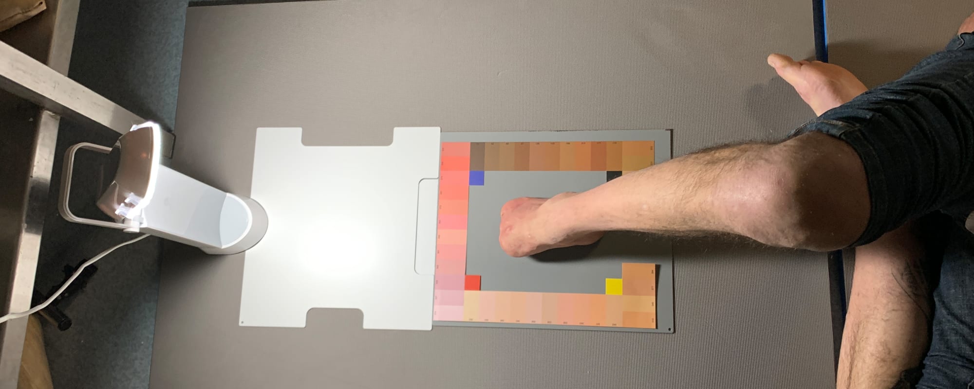 Ossur Cosmetic Prosthetic Solutions. Ossur.com