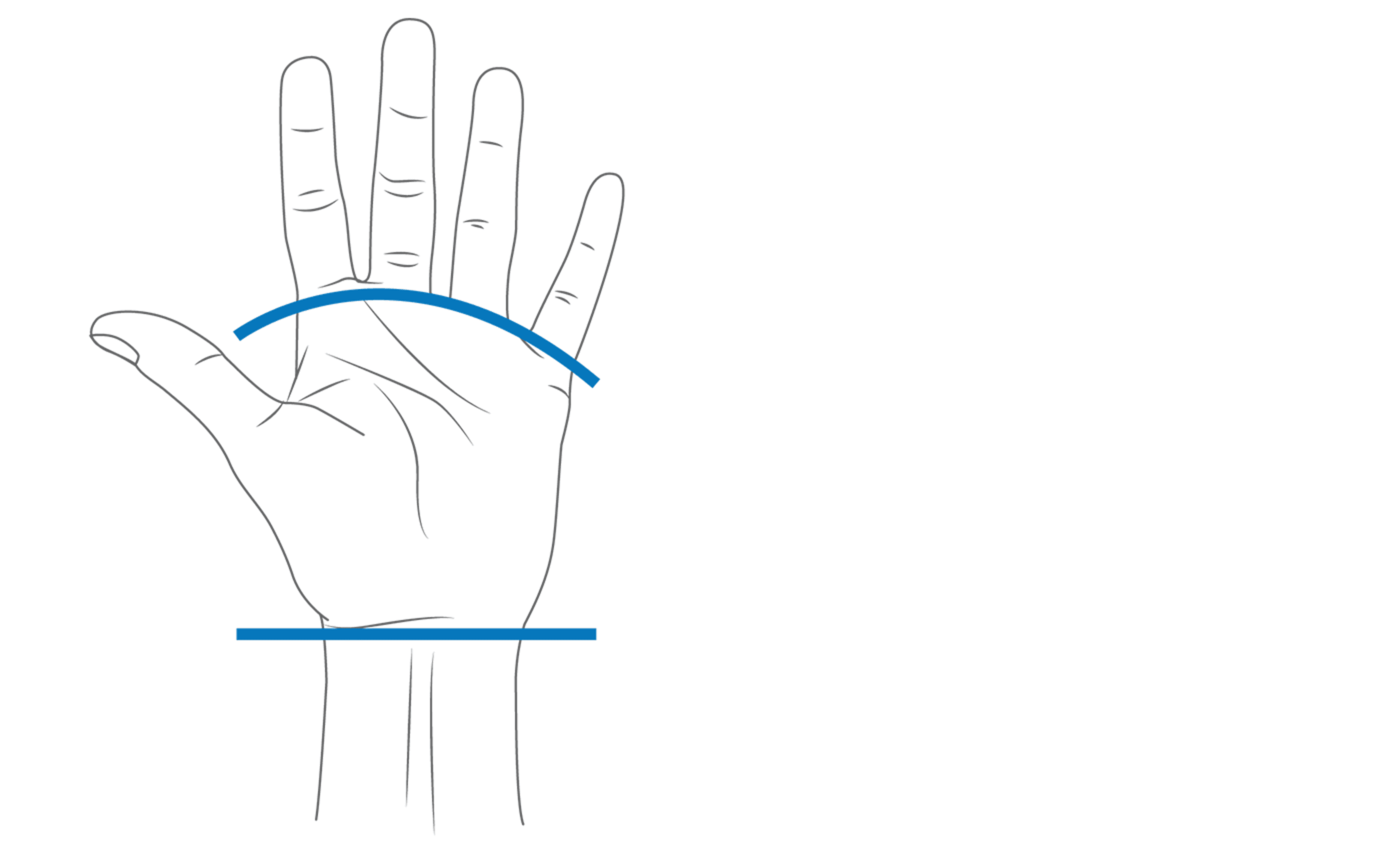 i-Digits Fitting & Fabrication | Össur Academy Touch Solutions