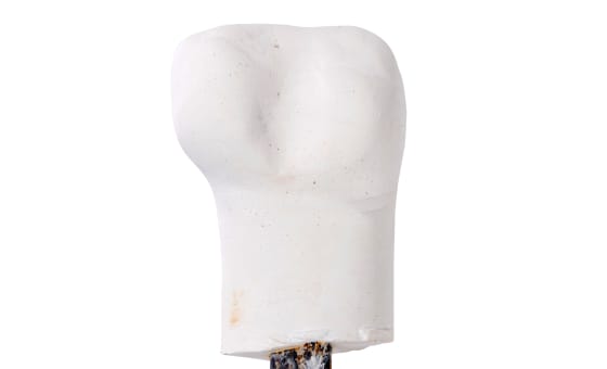 i-Digits Fitting & Fabrication | Össur Academy Touch Solutions