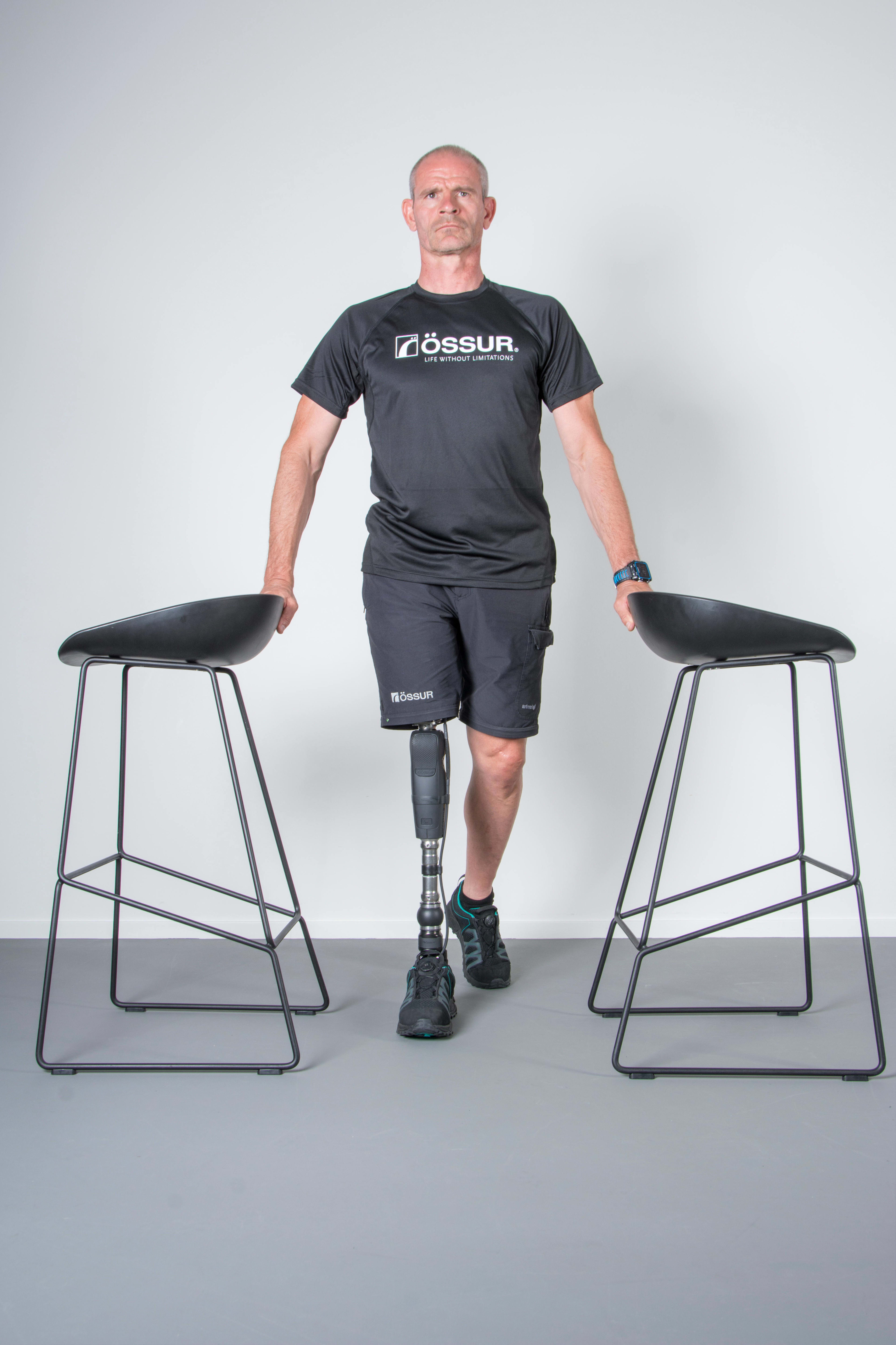 One Visit Prosthetics | Leg and Socket Solutions | Össur UK