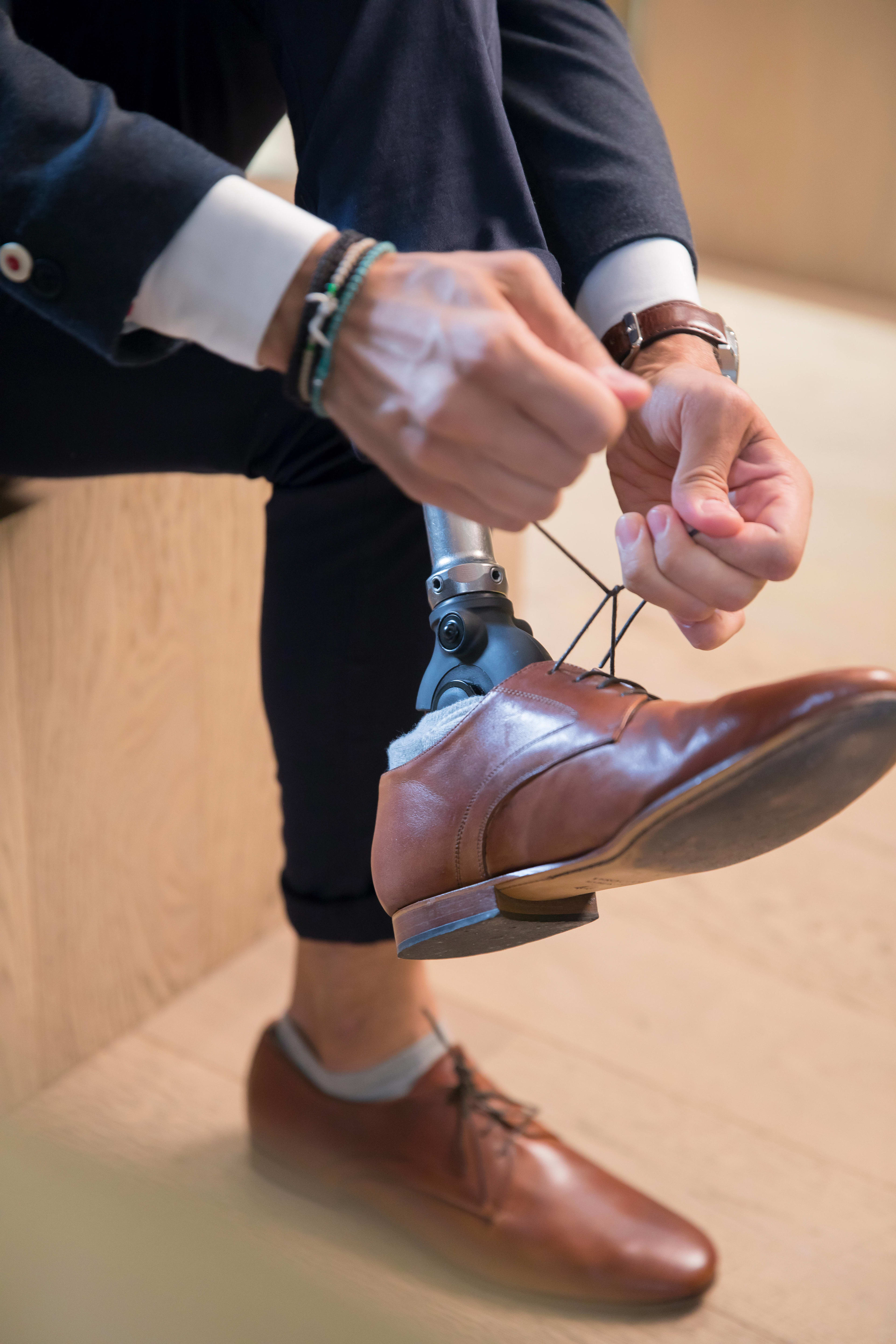 One Visit Prosthetics | Leg and Socket Solutions | Össur UK