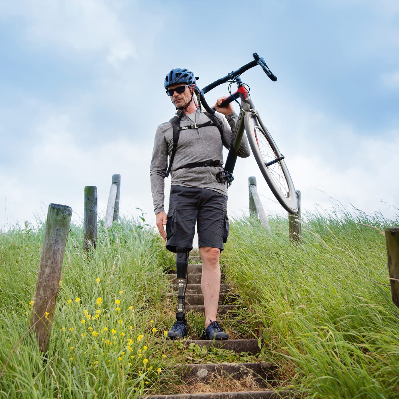 Direct Socket | Frequently Asked Questions | Össur UK