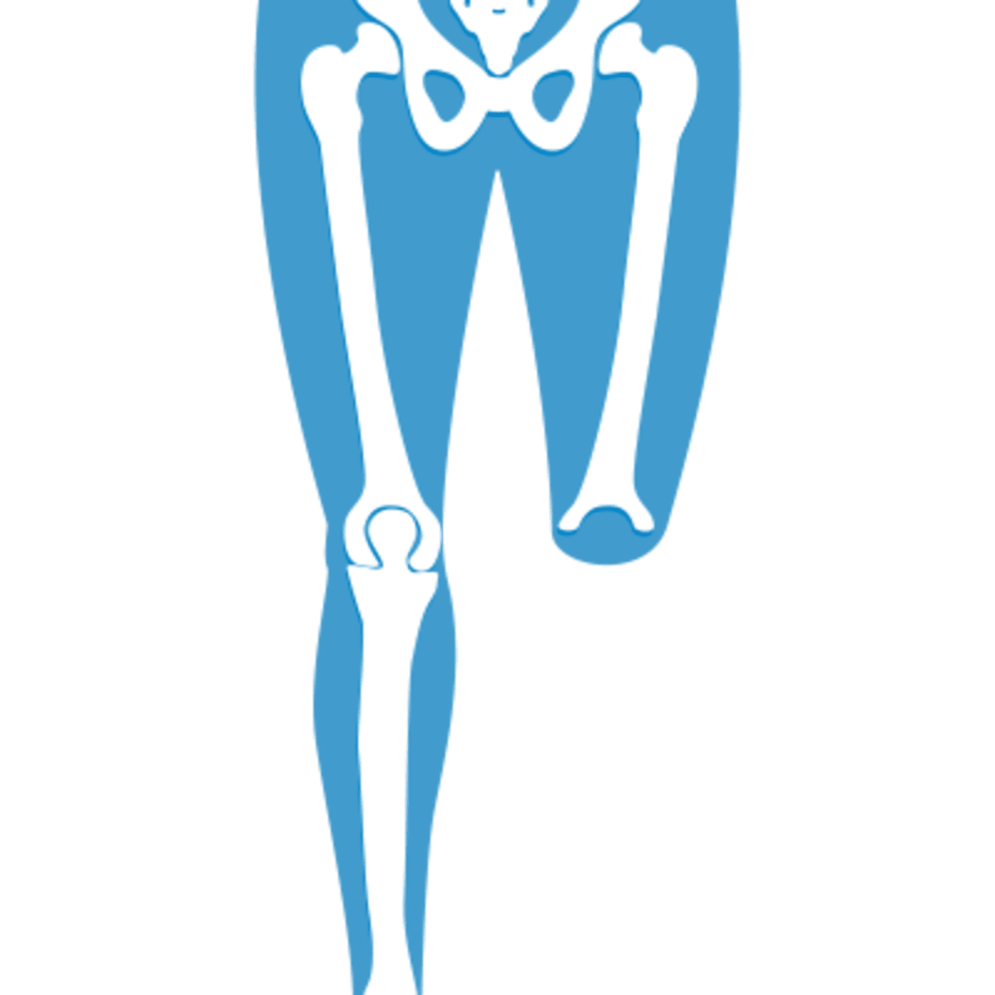 About Leg Amputation. Ossur.com