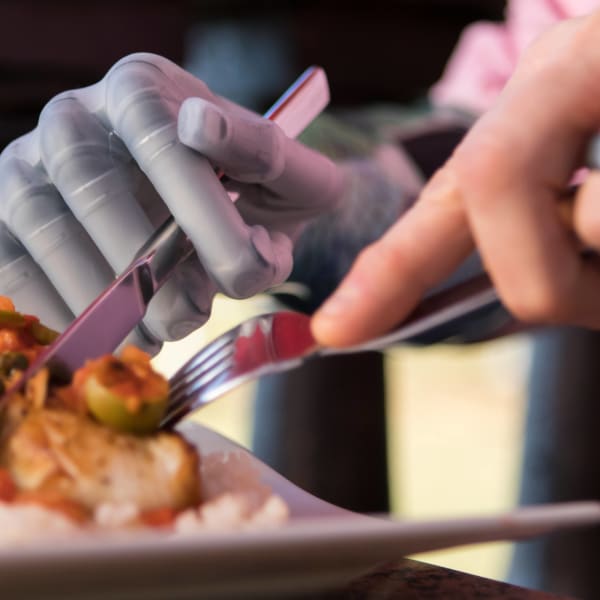 Touch Solutions Upper Limb Prosthetics | Ossur