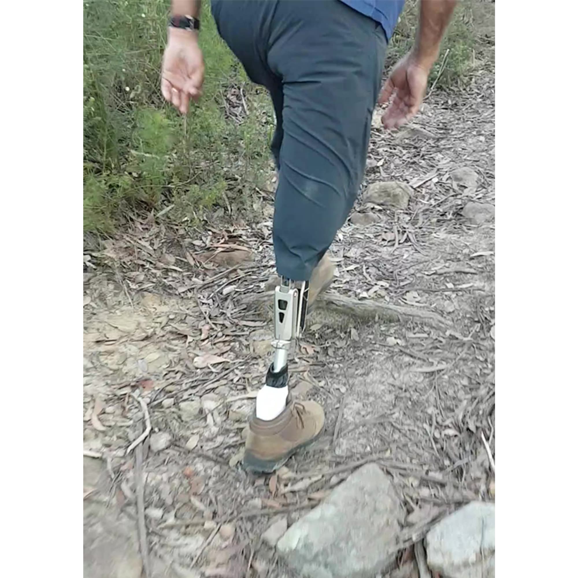 Gordon Richard's PASO Knee & Pro-Flex Story. Ossur.com