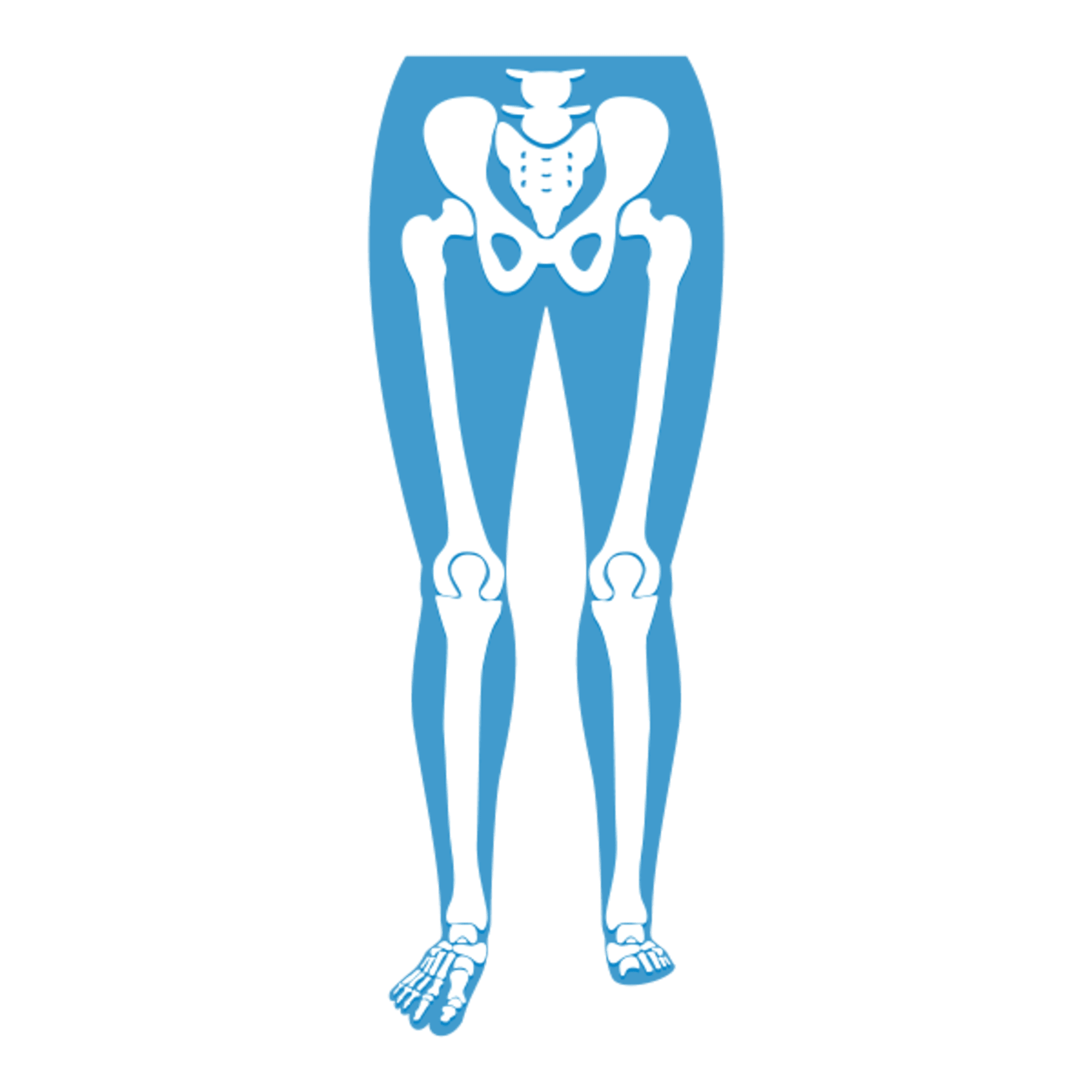 De ingreep. Amputatie en revalidatie. Ossur.com