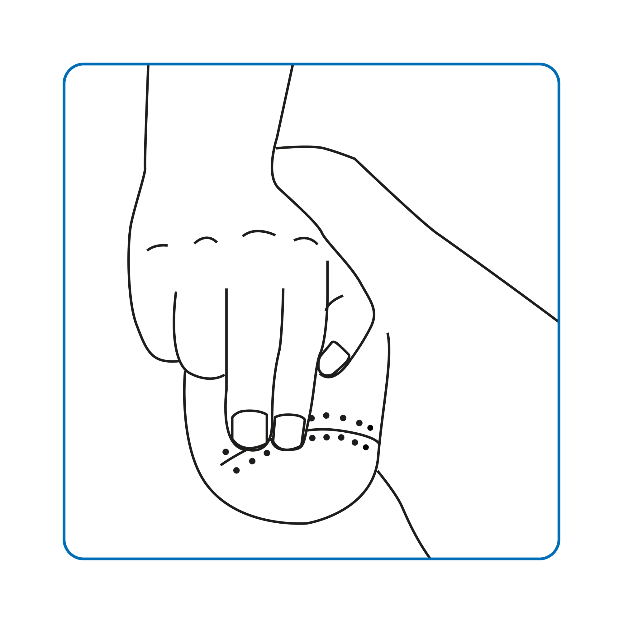 Die Rehabilitation: Wie läuft sie ab? | Össur Deutschland