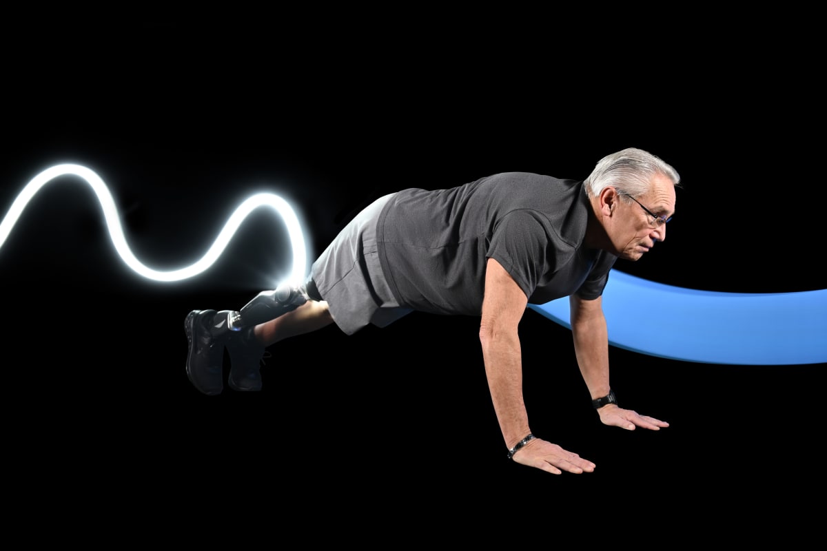 Prótesis Biónicas Miembro Superior y Inferior | Össur