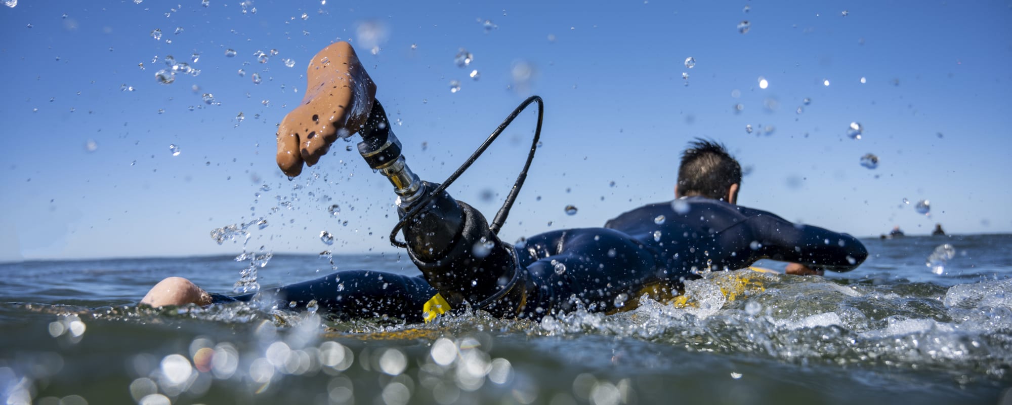 Waterproof Prosthetic Devices by Össur
