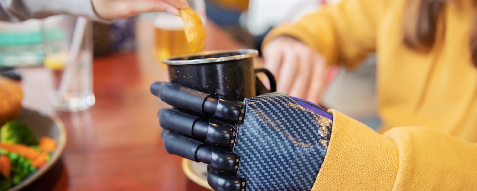 Introduction to i-Digits | Össur Academy Touch Solutions