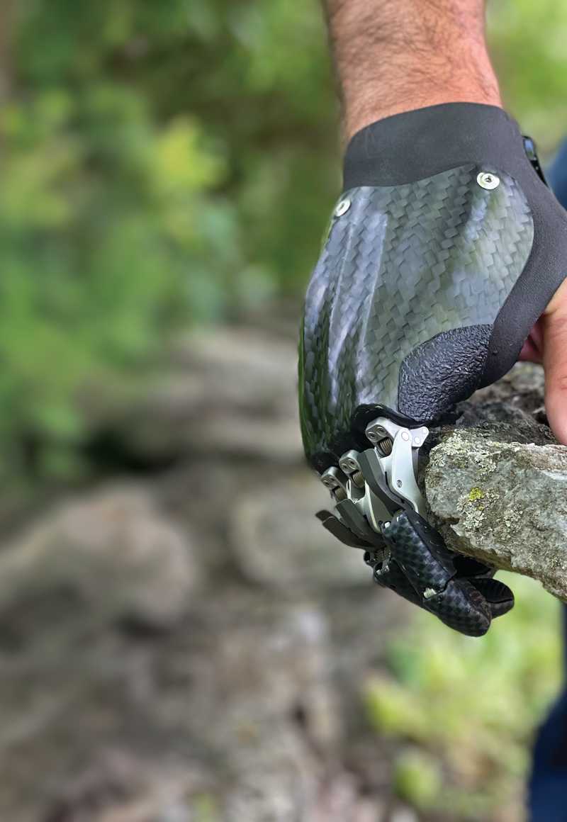 Moises : 3 prothèses de main, une histoire | Naked Prosthetics