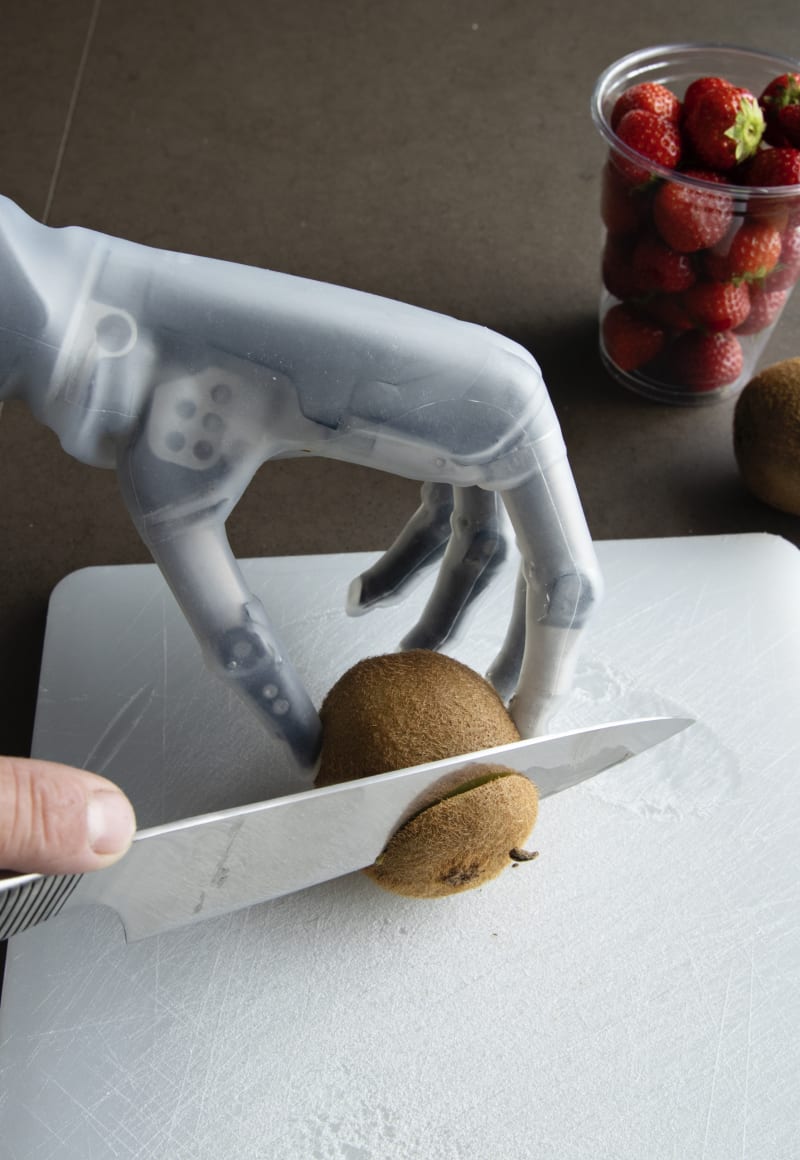 Information för personer med amputerade övre extremiteter | Ossur