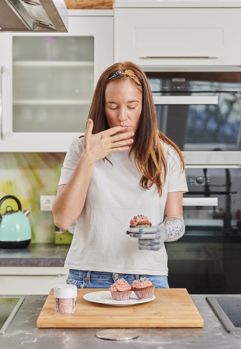 NHS funding for prosthetic hands | Ossur