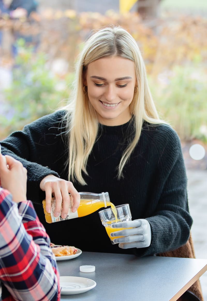 Össur. NHS funding for prosthetic hand. Ossur.com