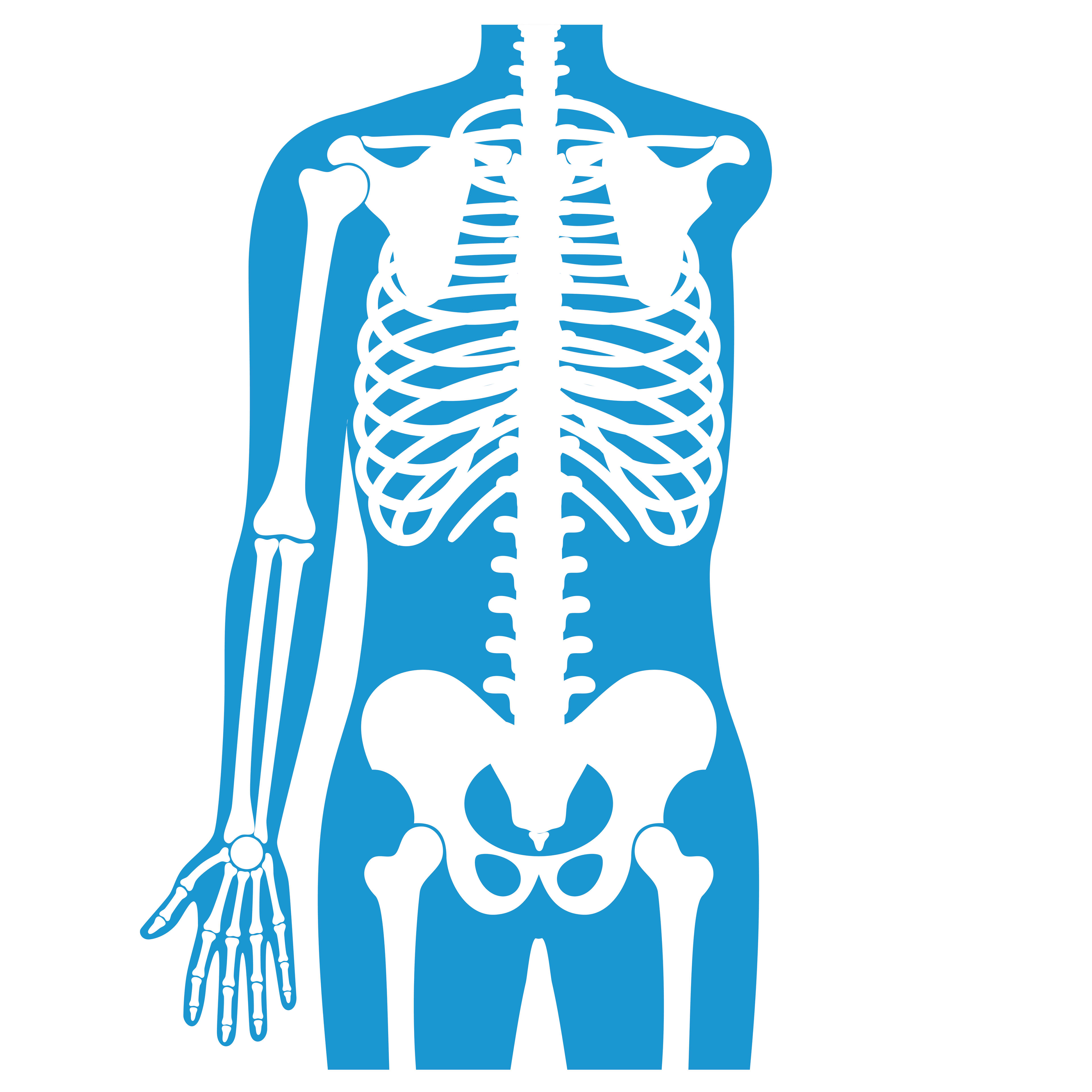 Amputationsarten- und höhen | ossur.com