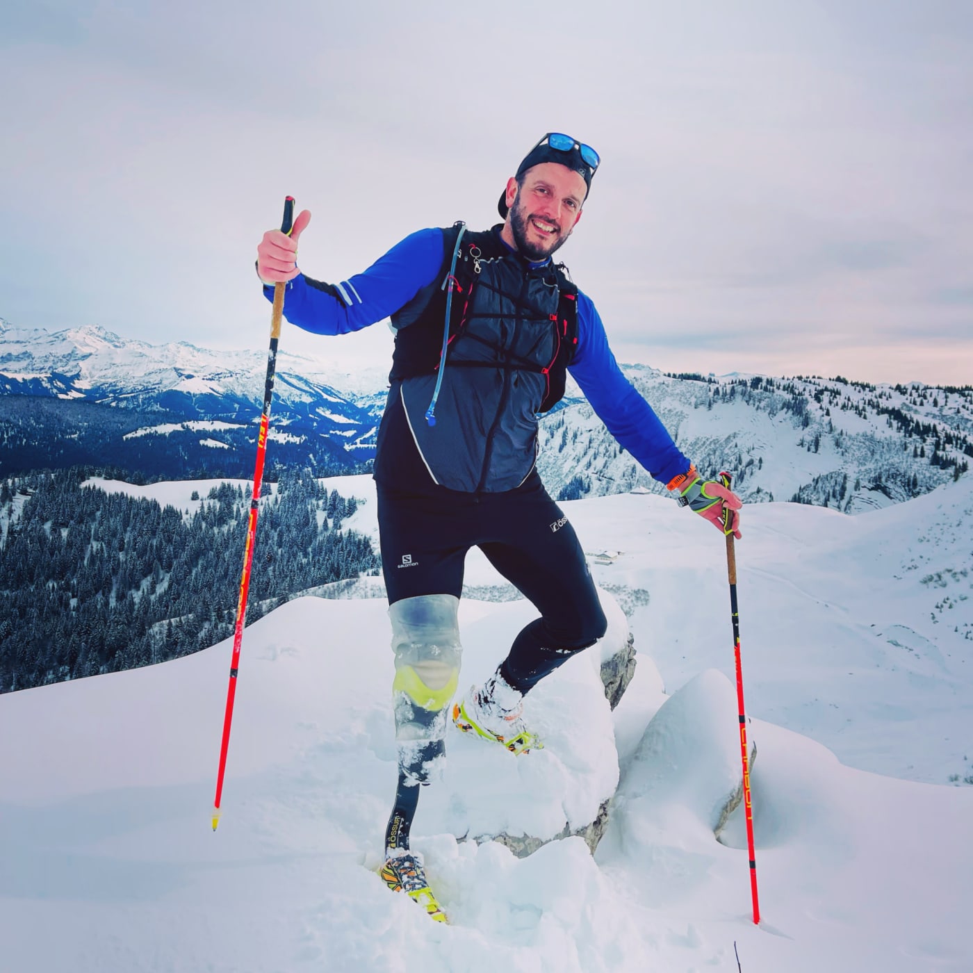 Quelle prothèse de jambe pour faire du sport