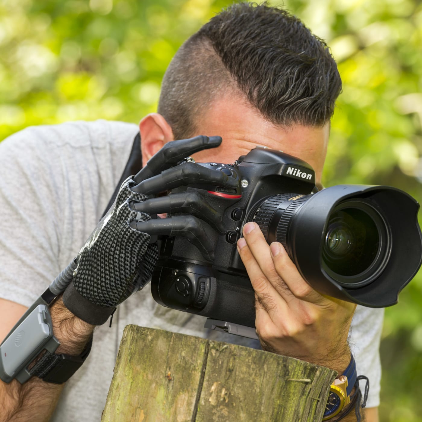 NHS approved Funding for Multi-Grip Hands | Prosthetic & Bionic Hands ...