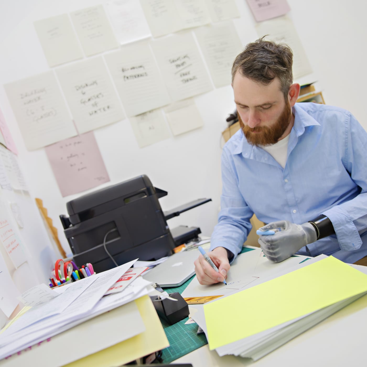 NHS approved Funding for Multi-Grip Hands | Prosthetic & Bionic Hands ...