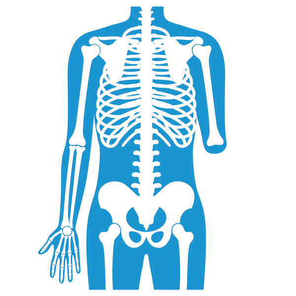 Understanding Upper Limb Amputation | Ossur