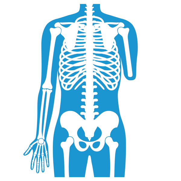 Understanding Upper Limb Amputation | Ossur