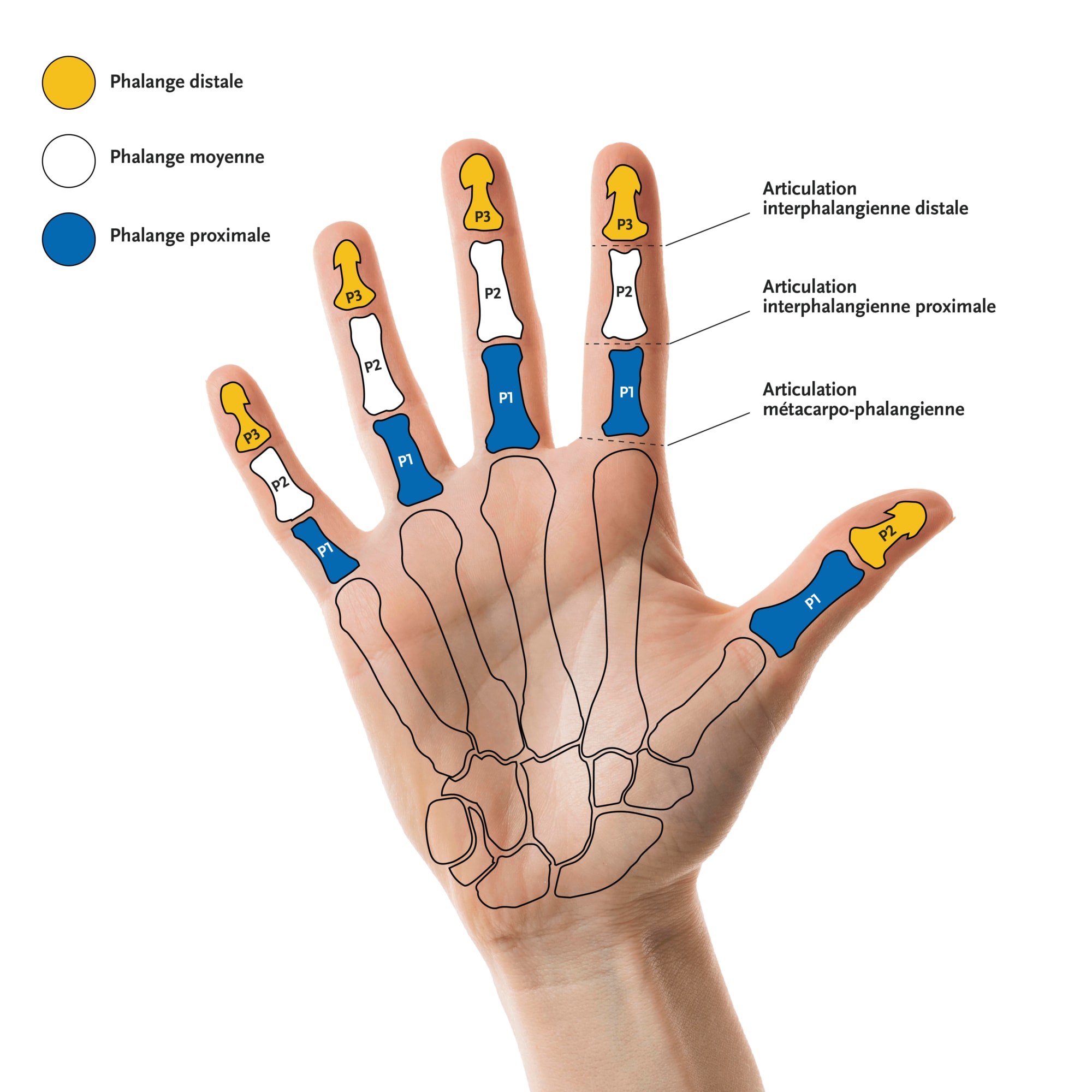 Amputation de doigt : parcours de soin et rééducation