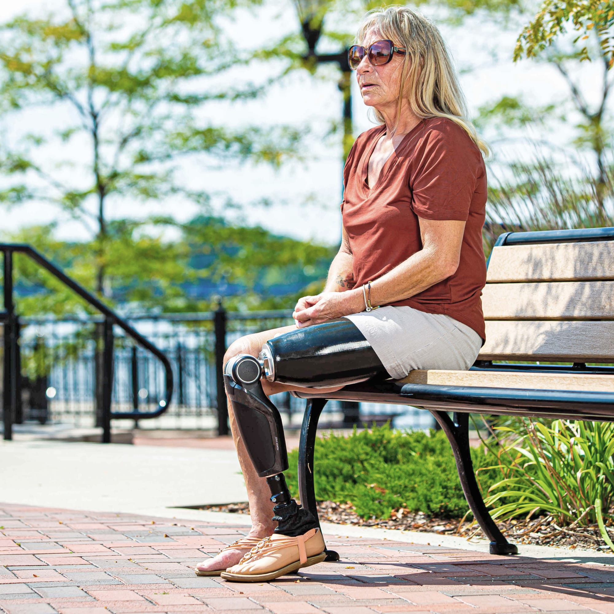 De quoi est composée une prothèse de jambe