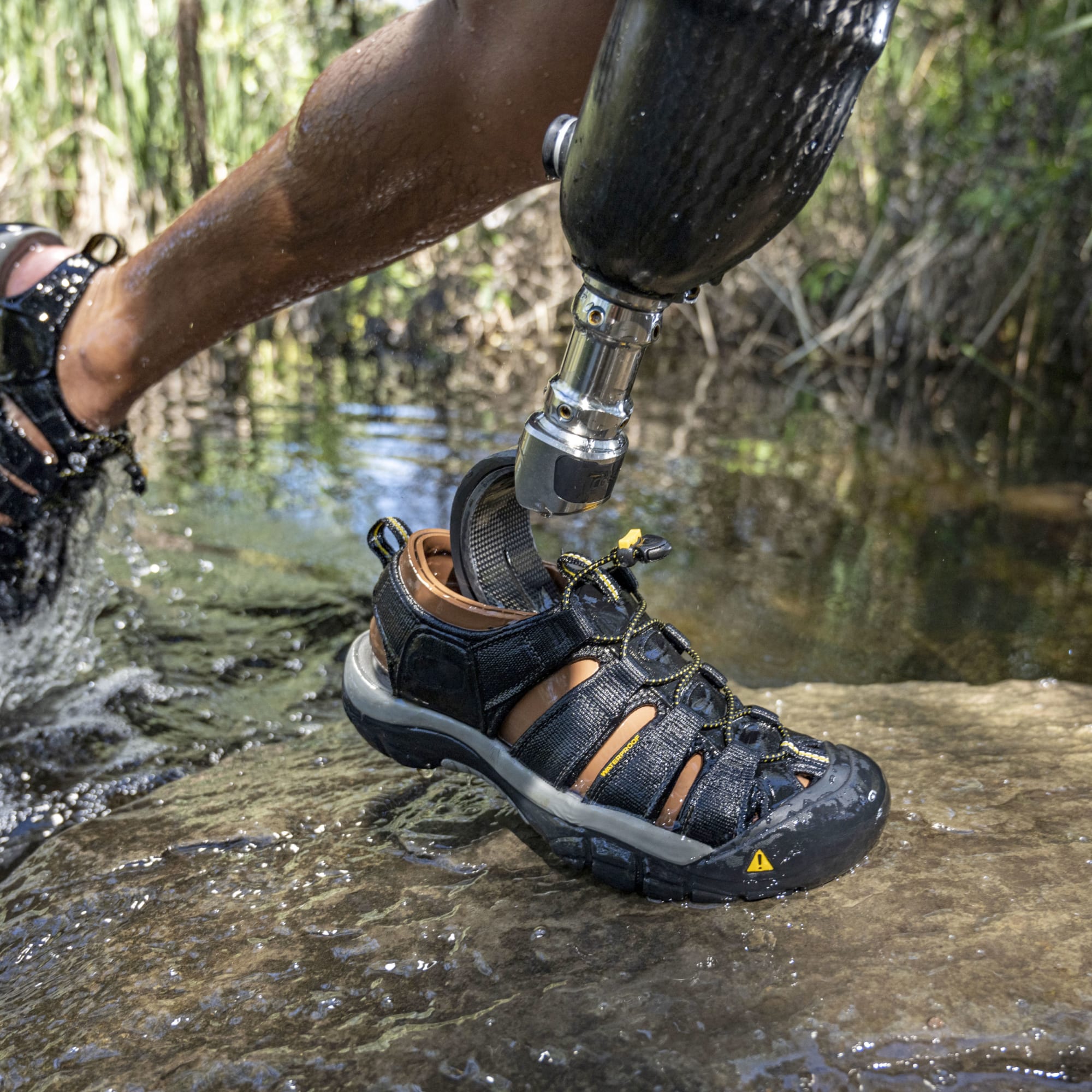 De quoi est composée une prothèse de jambe
